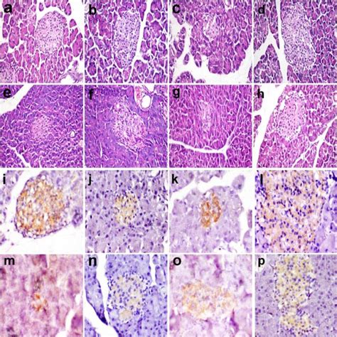 Pancreas Of Rats Showing Islets Of Langerhans In A Control Group B