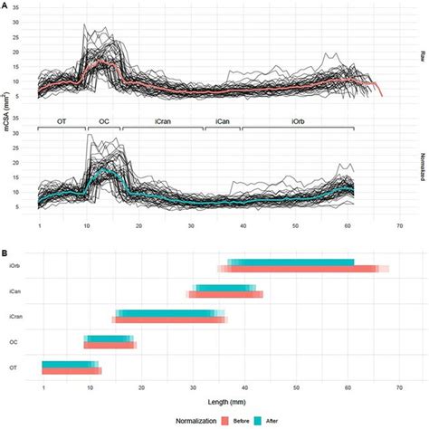 Results Of The Normalization Procedure A The Csa For Each Subject Download Scientific