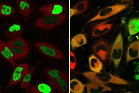 ابداع شیوه جدید برای جانمایی مجدد پروتئین‌ها در سلول‌ها ایرنا