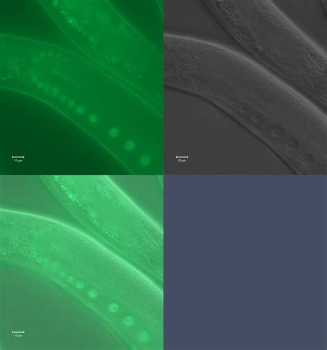 Transcription Factor Chip Seq