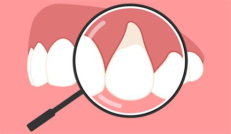 Viral Infection What Is Symptoms Diagnosis And Immunity