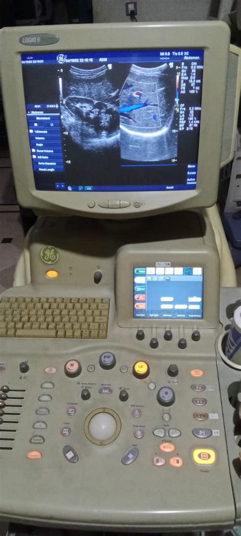 Ge Logic 5 Expert Medical Equipment Consultant