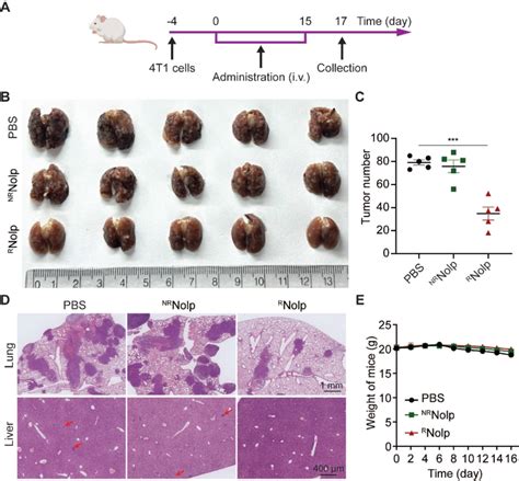 R Nolp Inhibits Tumor Growth In A Metastasis Mouse Model Of Tnbc A