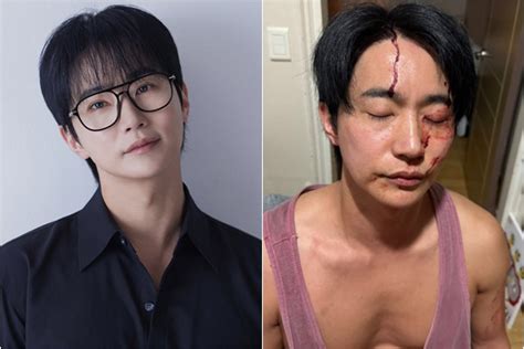 전호준 전 연인 교제폭행 주장에 반박⋯정당방위 자택 무단 침입 제지한 것