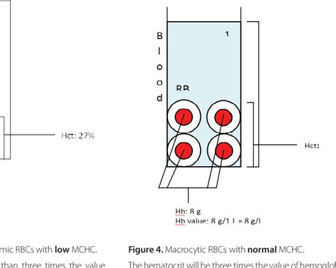 Hemoglobin Hematocrit Dehydration At Gladys Kestner Blog