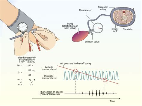 Blood Pressure Cuff Diagram