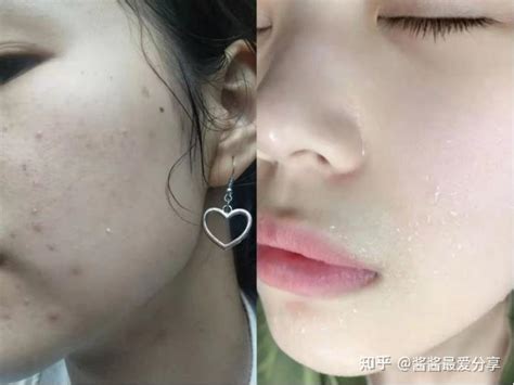 长期失眠睡不好，皮肤差，该怎么改善？ 知乎