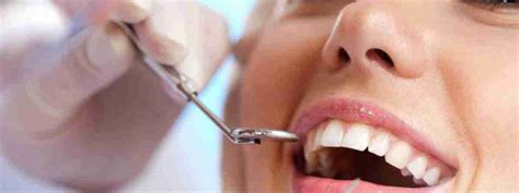 Зубний камінь його профілактика і наслідки