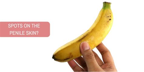 What Is The Cause Behind The Black Spots On Penile Skin