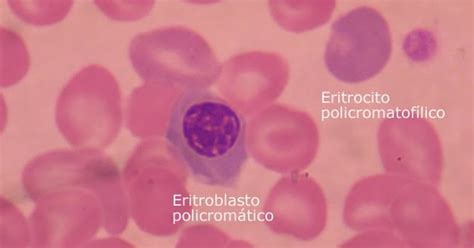 Fichero De Hematología Heber Mayén Eritroblasto Policromatófilo