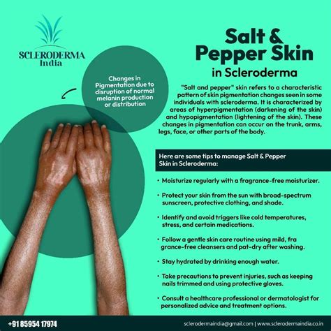 Scleroderma India On Linkedin Sclerodermaindia Saltandpepper