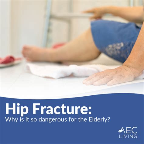 Hip Fractures And What They Mean For The Elderly Aec Living