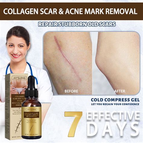 Scar Remove Repair Skin Essential Oil Collagen Scar And Acne Mark