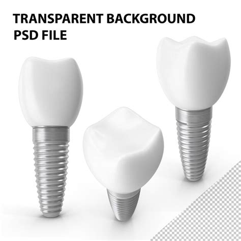 Premium Psd Implant Teeth Png