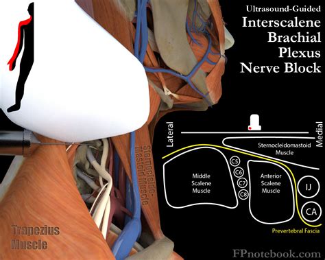 Interscalene Block Interscalene Block Clinical Gate