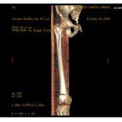 Computed Tomography Image Download Scientific Diagram