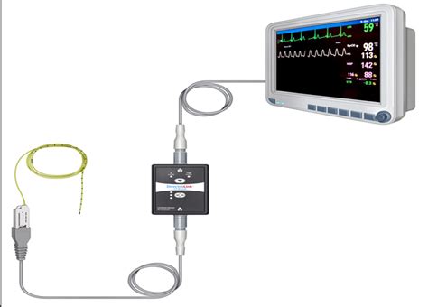 Intracranial Pressure Sensor Codman Neuro