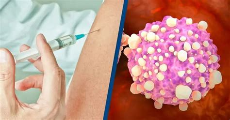 Cáncer De Páncreas Los Detalles De La Nueva Vacuna De Arnm Que Mostró