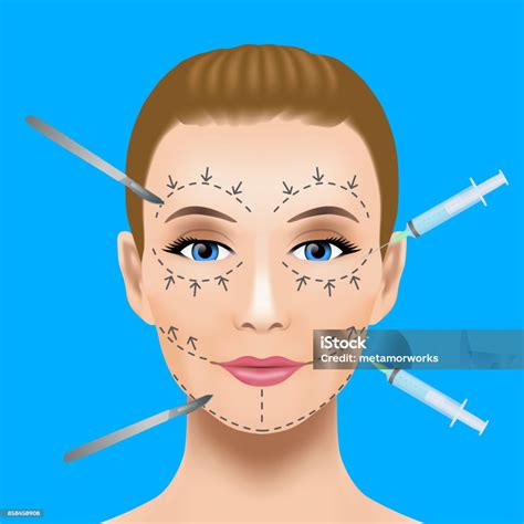 성형 수술 개념입니다 보톡스 주사입니다 여자 얼굴 주름 치료입니다 보톨리눔 독소 주사에 대한 스톡 벡터 아트 및 기타 이미지