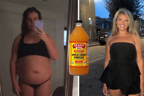 Does Drinking Apple Cider Vinegar Help You Lose Weight 5 Stay At Home