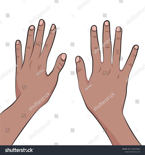 Marfan Syndrome Hand Test