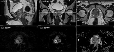 Multiparametric Mr Imaging Of The Mri Technologist