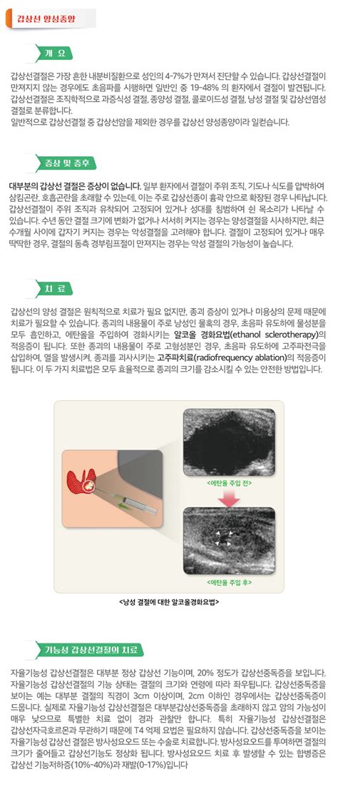 갑상선 양성결절