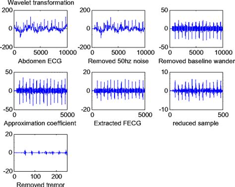 Fetal Ecg Extraction Using Wavelet Transformation Technique For Event 1