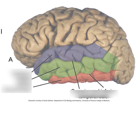 Temporal Lobe Lateral Surface Diagram Quizlet