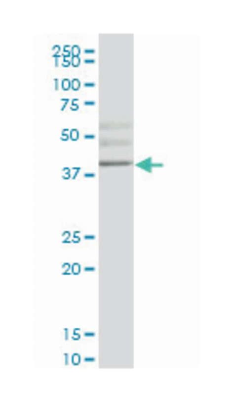 Anti Hhex 3f11 100ug