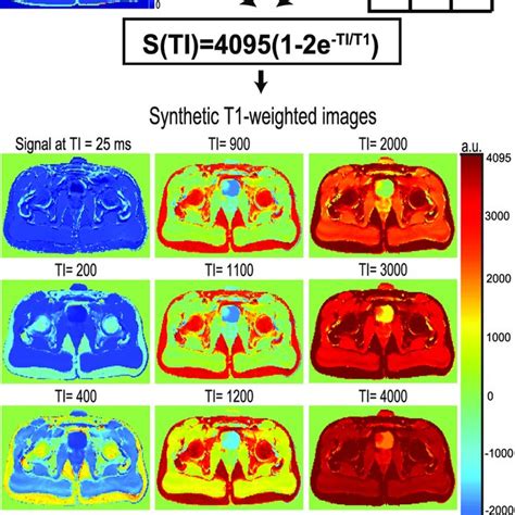 Pipeline Of The Segmentation And Classification Process Using The Svm Download Scientific