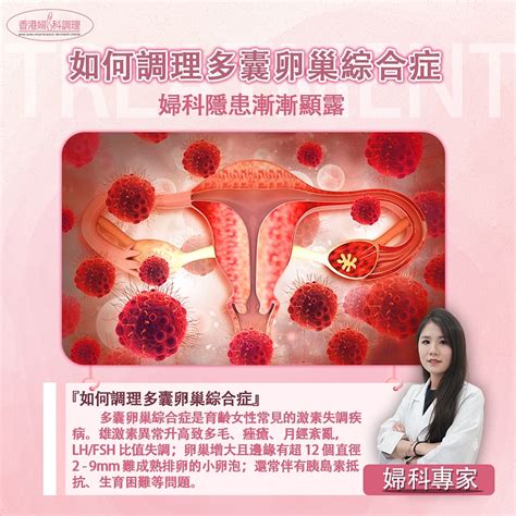 香港婦科調理（旺角店） 🌸 多囊卵巢綜合症不可怕，用心調理很重要！ 🌸 多囊卵巢綜合症是育齡女性常見的內分泌失調疾病，影響身體健康和生活