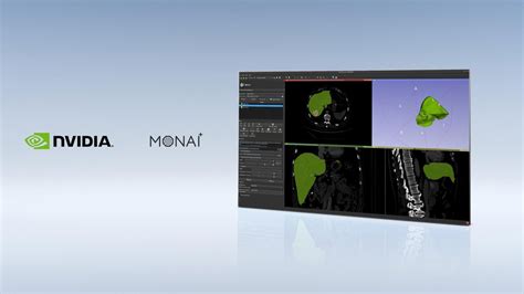 MONAI 影像框架快速進入生產階段加速 AI 醫療領域的發展 NVIDIA 台灣官方部落格
