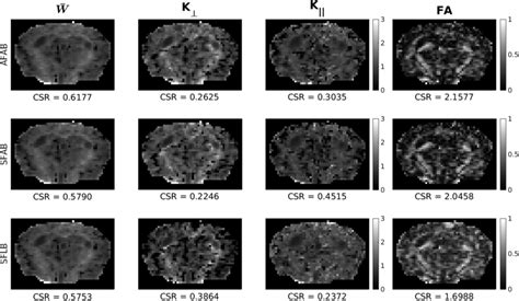 Comparison Of Kurtosis And Fa Maps When Using Various Methods To
