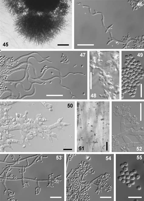 Hypocrea Pachybasioidestrichoderma Polysporum Anamorph 45 Part Of A
