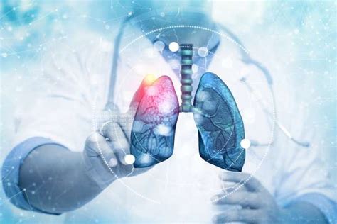 Diagnosing And Treating Lung Cancer Open Lines