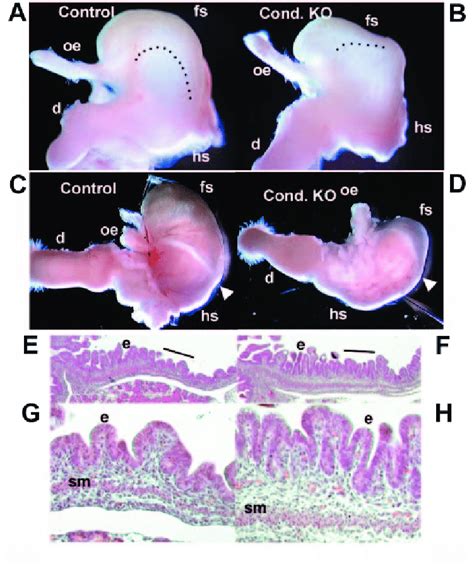 Analysis Of Ap Patterning Defects In Conditional Coup Tfii Mutant
