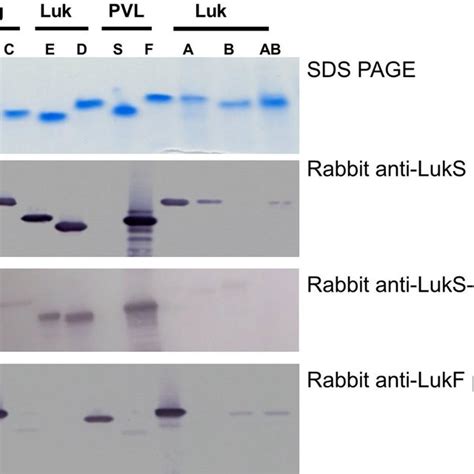 SDS PAGE And Western Blot Of Different Subunits A SDS PAGE B