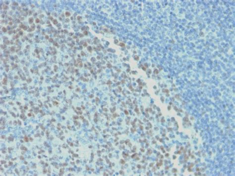 Bcl 6 Follicular Lymphoma Marker Monoclonal Antibody Rbcl6 1718 604 Msm14 P0