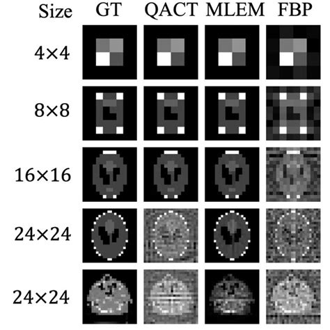 A Real Number Image Reconstruction Using 36 Projection Angles The Top Download Scientific