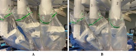 A Elbows Are Angled Acutely To Allow For Maximum Reach Deep Into The