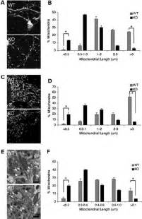 Dj 1 Deficiency Results In Altered Mitochondrial Morphology In Vitro