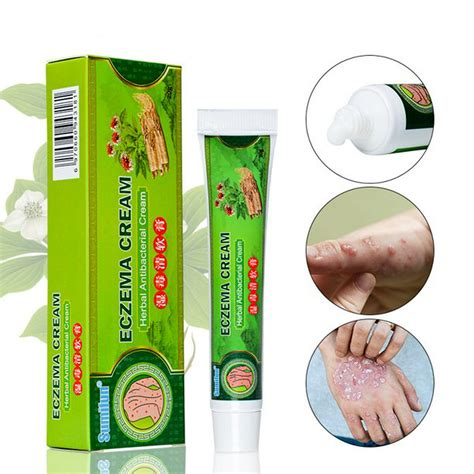 Crema Eczema Piel Seca Tratamiento Eczema Crema Caléndula