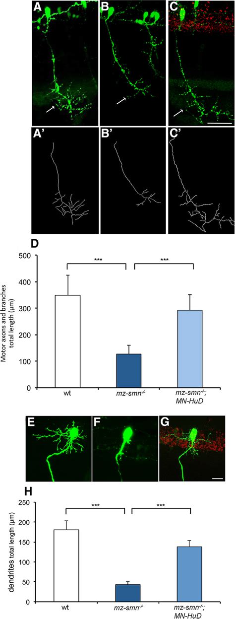 Expressing Hud In Smn Depleted Motoneurons Rescues The Axon Branching