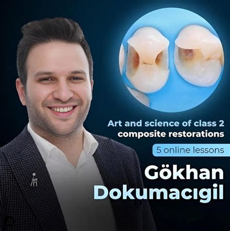 Art And Science Of Class 2 Composite Restorations Dental Knowledge