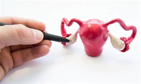 什麼是腹膜腔溫熱療法？卵巢癌患者治療先看優缺點 康健雜誌