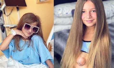 患罕見病天生心臟外露 11歲女童樂觀面對人生 生活熱話