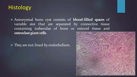 Simple And Aneurysmal Bone Cyst Definition Classfication