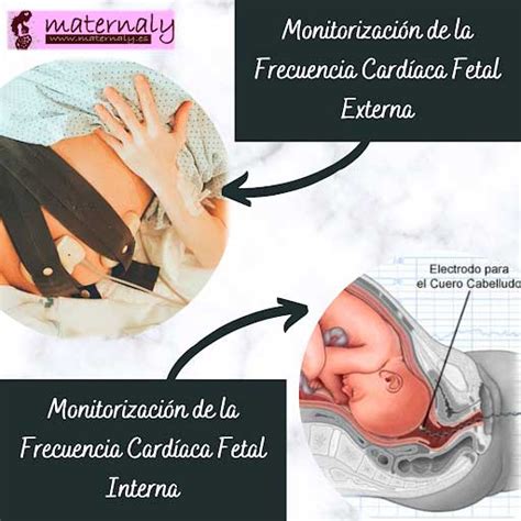 Frecuencia Cardiaca En El Embarazo Maternaly