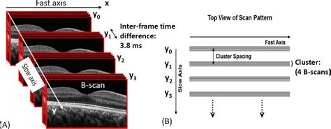Figure 1 From Swept Source Oct Angiography Of The Retinal Vasculature Using Intensity